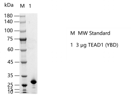 TEAD1 (YBD) - Other Protein - ICE Bioscience - Protein platform