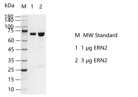 ERN2 - Other Kinase - ICE Bioscience - Protein platform