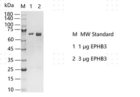 EPHB3 - Tyrosine Kinase - ICE Bioscience - Protein platform